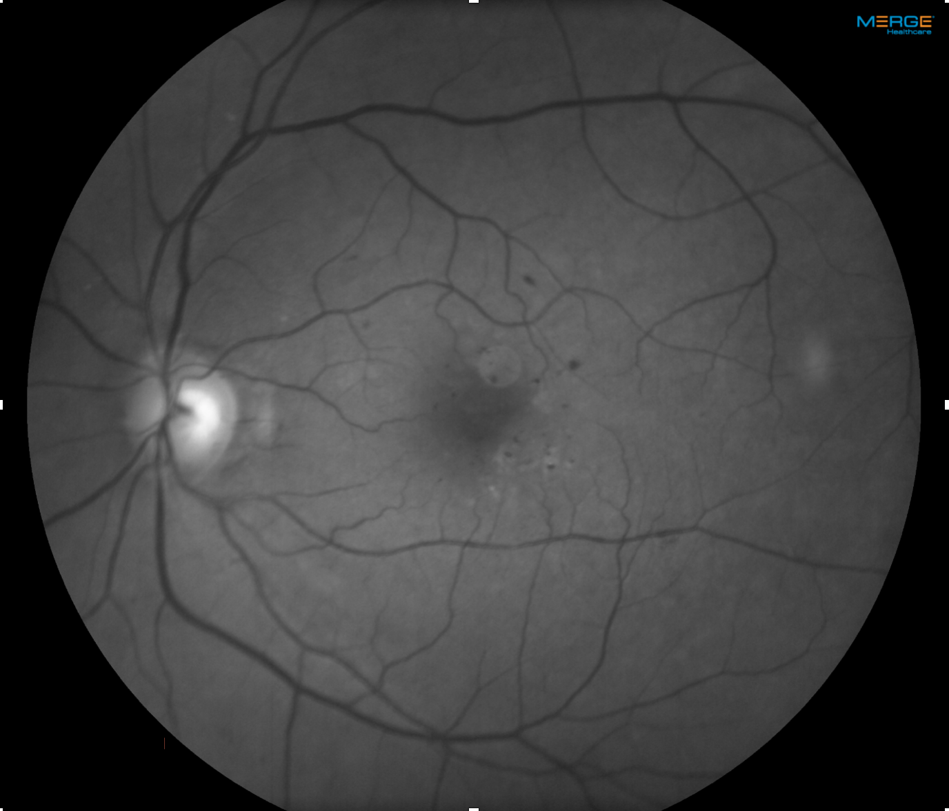 Case 6: Ophtho Visit