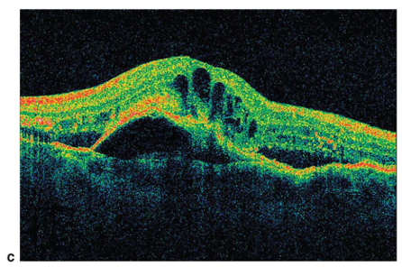 Case 7: Diagnosis & Conclusions